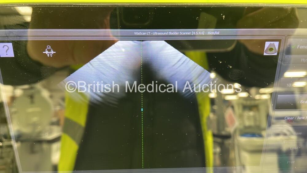 VitaCon Lamina VitaScan LT Ultrasound Bladder Scanner Software Version ...