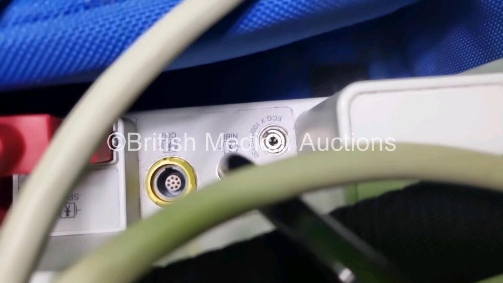 Zoll E Series Defibrillator (Powers Up) Including ECG, SpO2, NIBP, CO2 ...