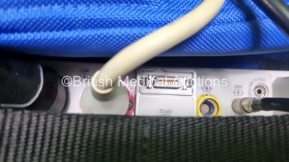Zoll E Series Defibrillator (Powers Up) Including ECG, SpO2, NIBP, CO2 ...