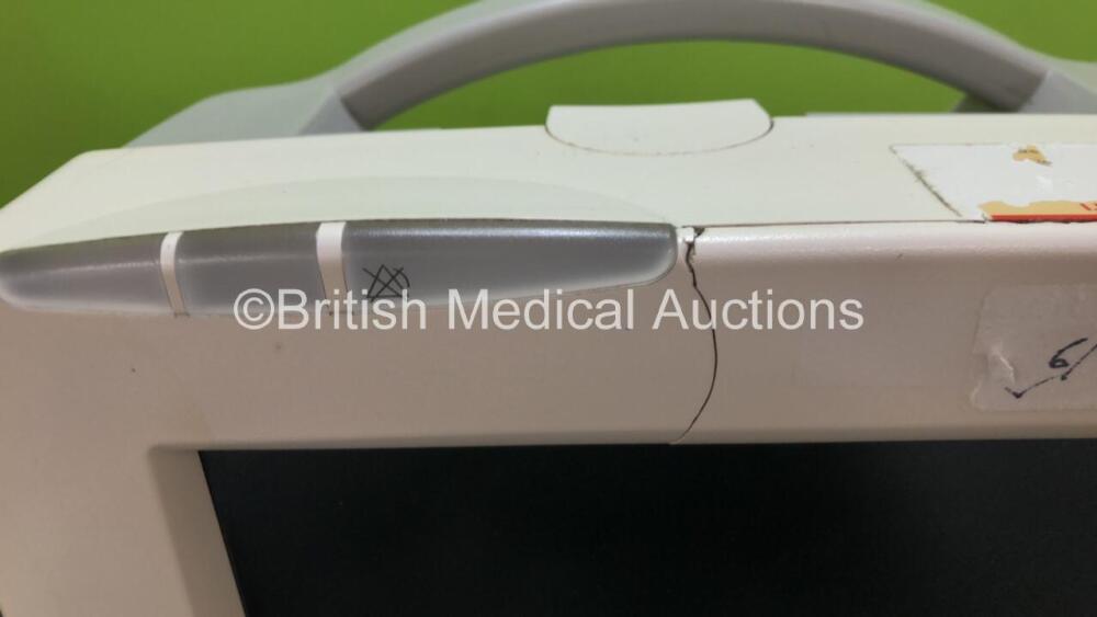 Philips IntelliVue MP30 Patient Monitor (Powers Up, Damage to Casing ...