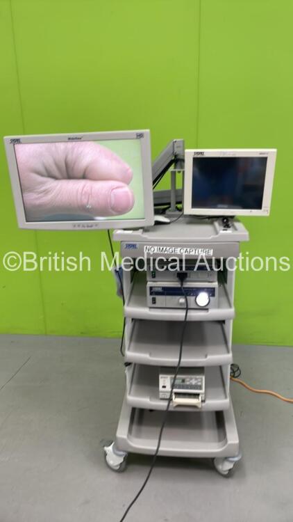 Storz Stack System with Storz WideView HD Monitor, Storz 200903 31 ...