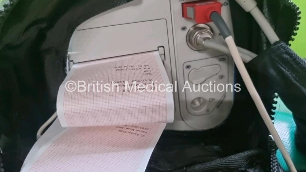 Zoll X Series Monitor / Defibrillator Including ECG, SPO2, NIBP, CO2 ...