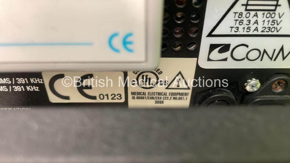 ConMed System 5000 Electrosurgical / Diathermy Unit with Footswitch ...