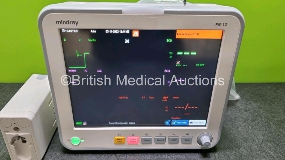 Mindray iPM 12 Patient Monitor (Powers Up) Including ECG, SpO2, IBP1 ...