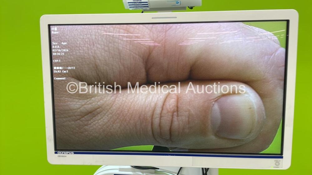 Olympus Stack System with Olympus OEV262H Monitor, Olympus UWIT-RX ...