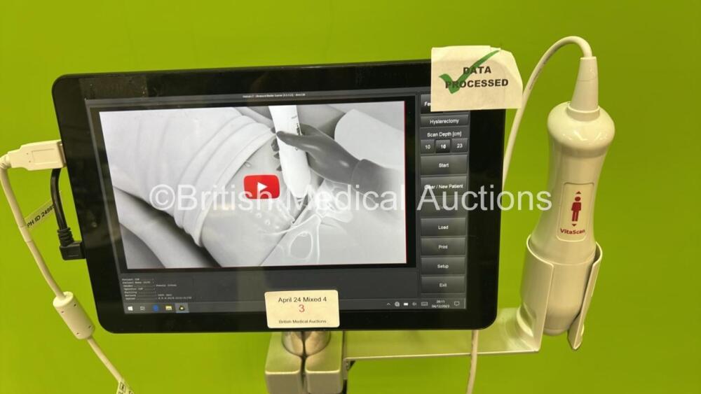 VitaCon Lamina VitaScan LT Ultrasound Bladder Scanner Software Version ...